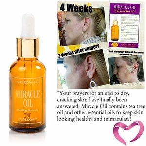 Pure Romance | Other | Miracle Oil By Pure Romance | Poshmark